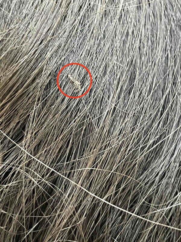 How to Check for Lice | Lice Removal Network