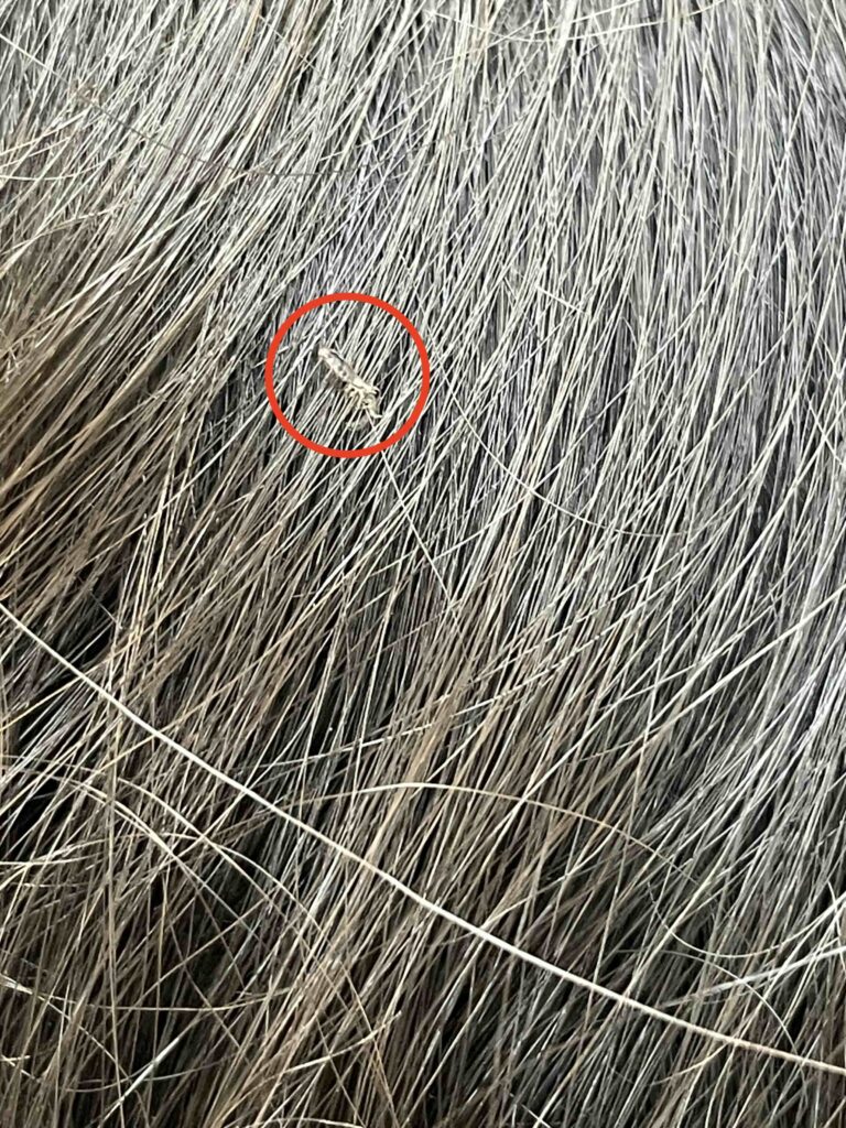 What Do Head Lice Look Like? A Closer Look at These Tiny Pests