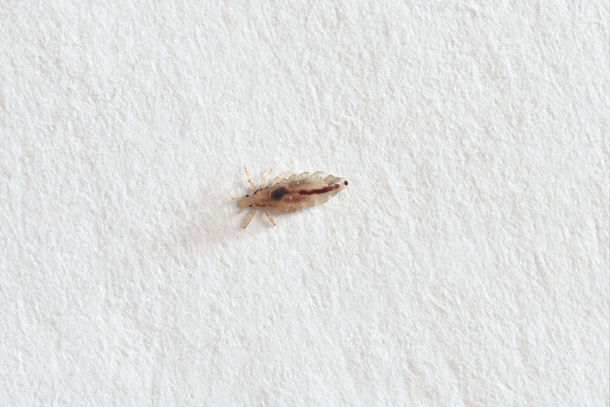 How to Check for Lice | Lice Removal Network